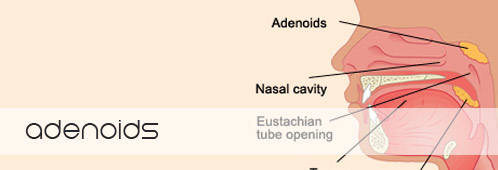 Homeopathic Medicines for ADENOIDS treatment